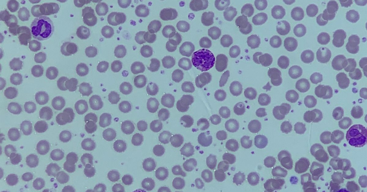 MedShr Learning | Taster module - an introduction to blood film morphology