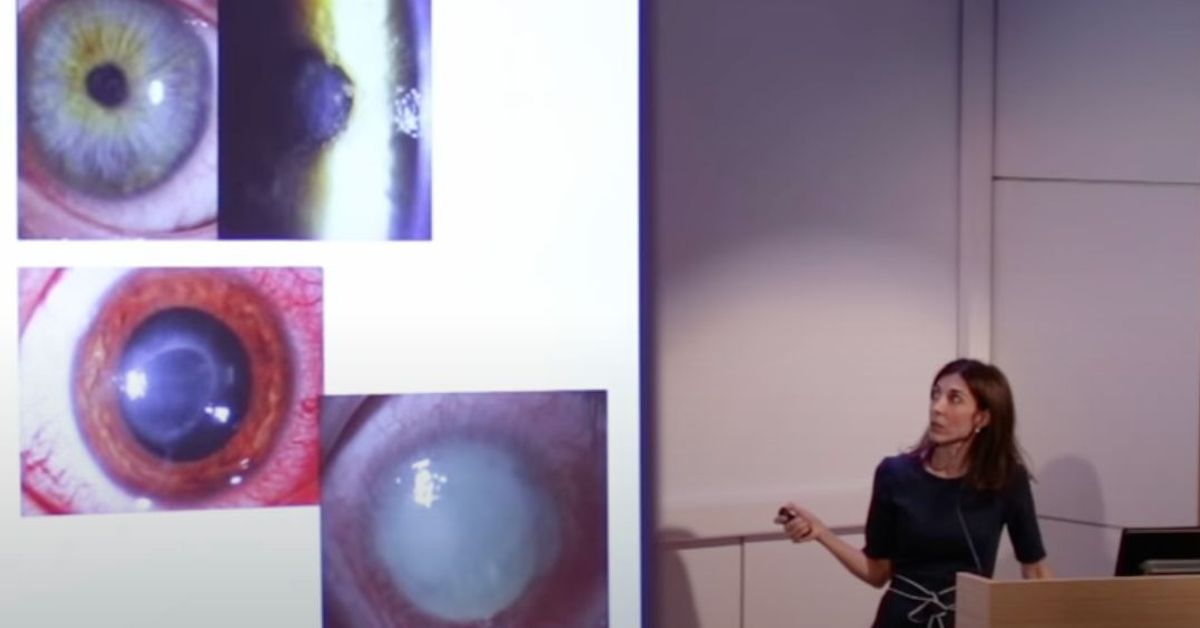 MedShr Learning | Red Flags in a Red Eye Presentation